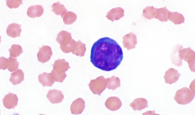 Povišeni i smanjeni limfociti, lym u krvi – rezultati, uzrok i lečenje